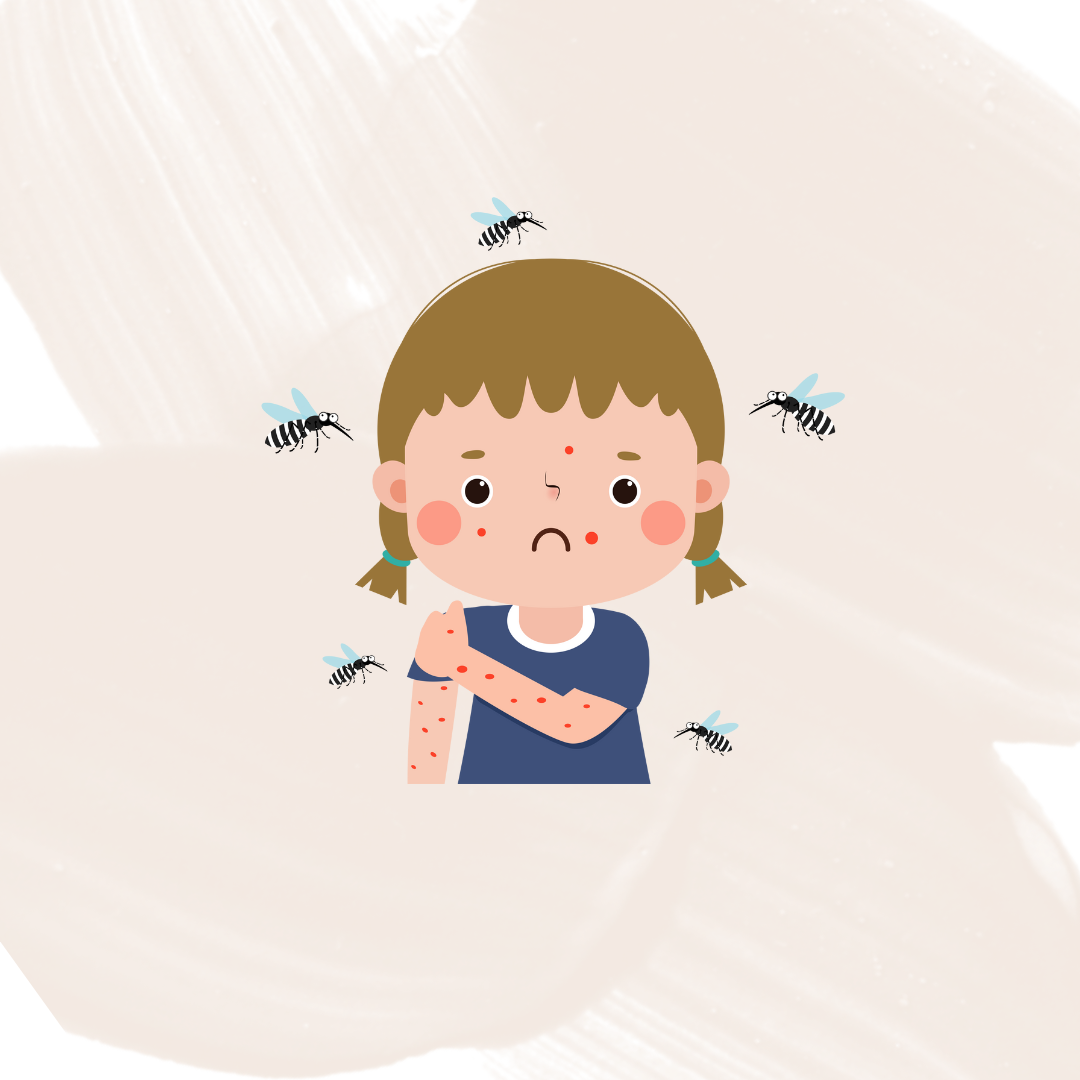 Skeeter Syndrome: When Mosquito Bites Swell Up – This Little Season